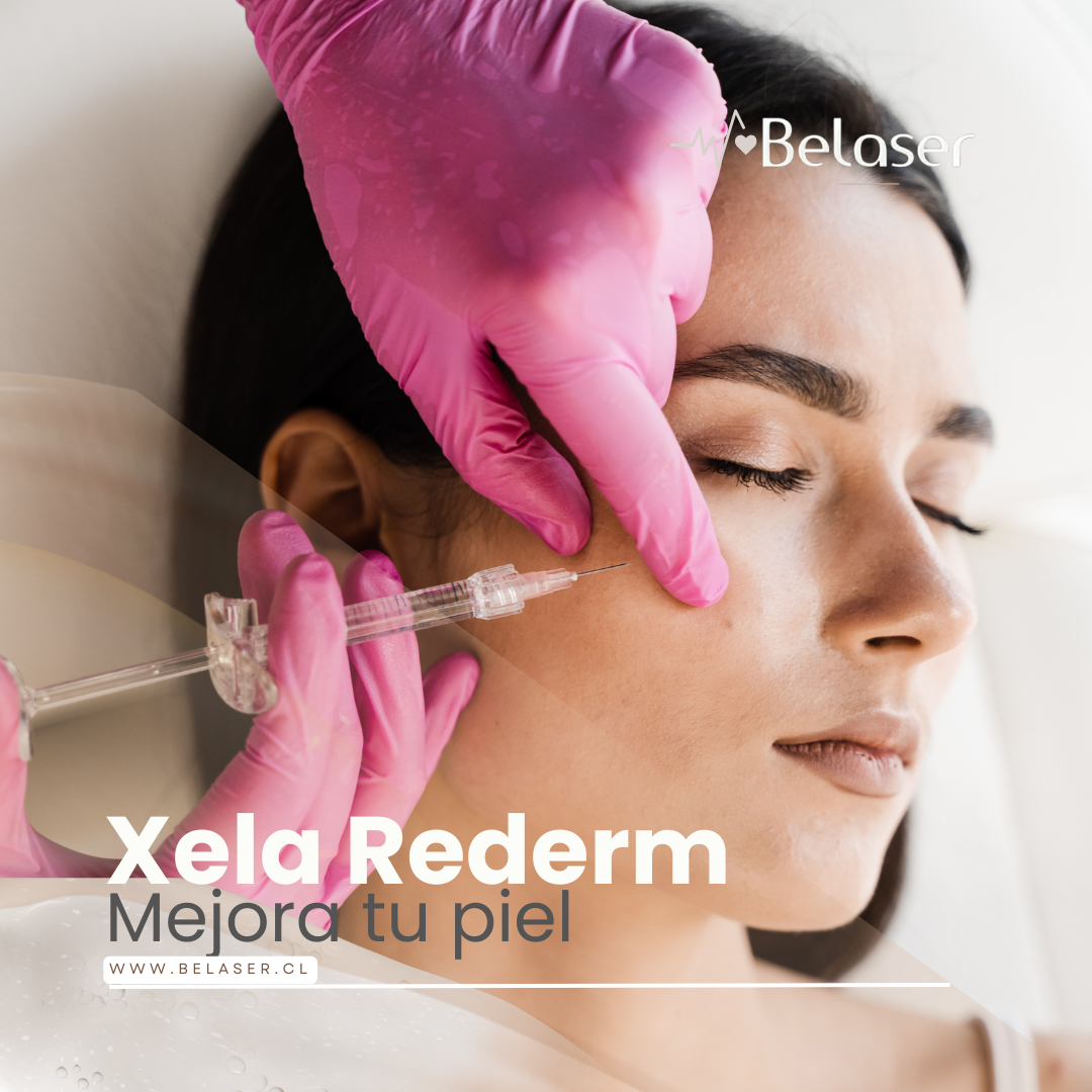 Mejora tu piel con Xela Rederm. – Belaser